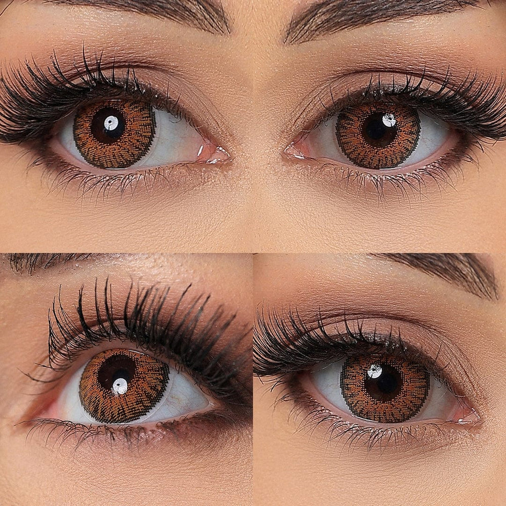 light brown limbal ring
